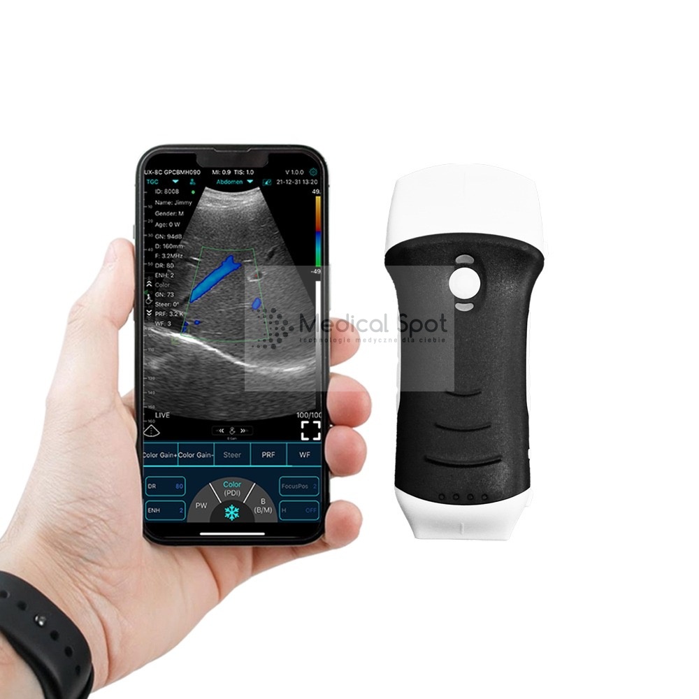 Przenośne USG na telefon. Ultrasonograf C10TX Convex, Linia, Kardio ...